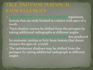 Periapical radiolucencies | PPTX