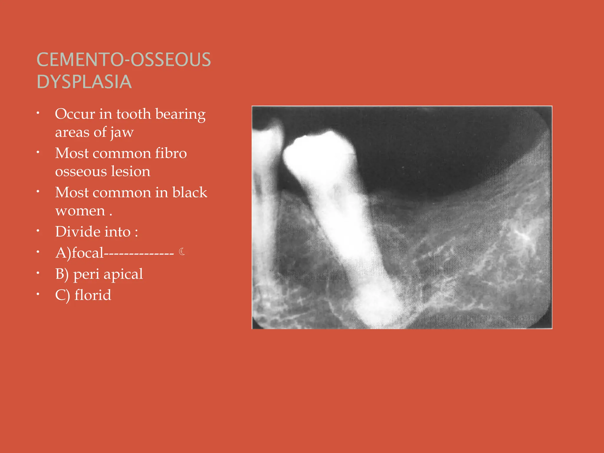 Tooth periapical radiolucencies and radiopacities.pptx