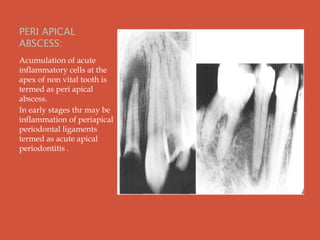 Tooth periapical radiolucencies and radiopacities.pptx