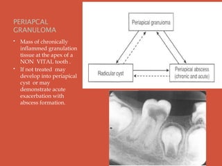Tooth periapical radiolucencies and radiopacities.pptx