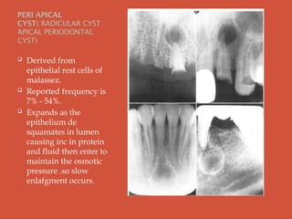 Tooth periapical radiolucencies and radiopacities.pptx