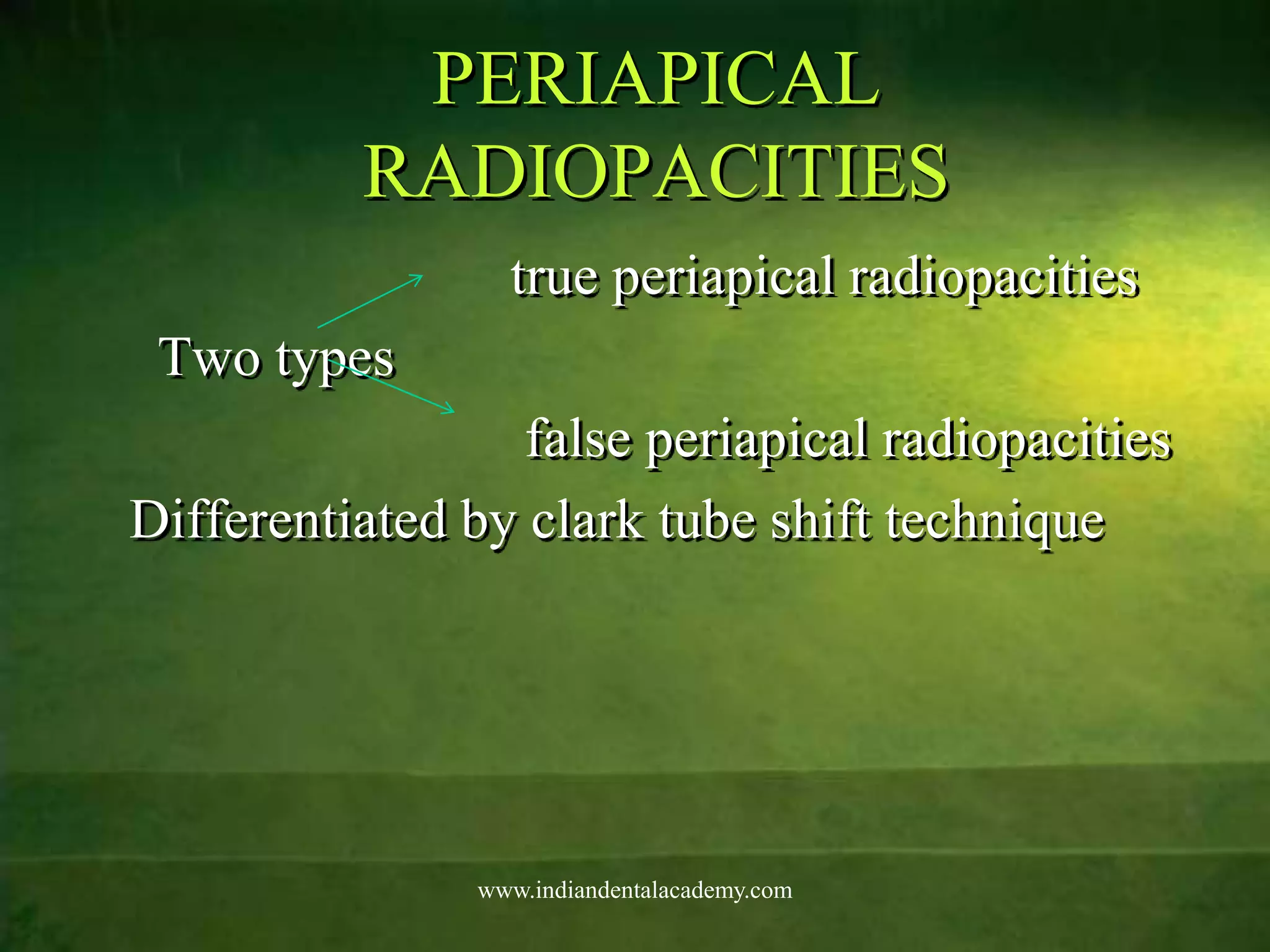 Periapical radiopacities/ dental implant courses | PPTX