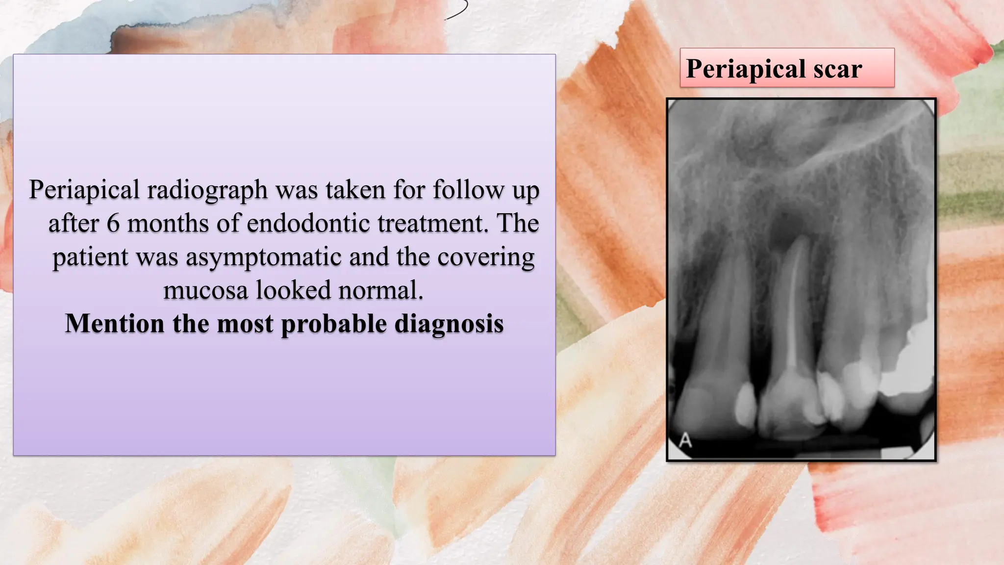 PERIAPICAL RL master.pdf oral and maxillofacial radiology | PDF