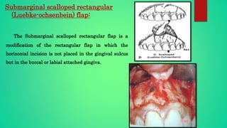 Periapical surgery viji | PPTX