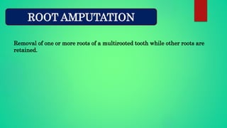 Periapical surgery viji | PPTX