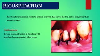 Periapical surgery viji | PPTX