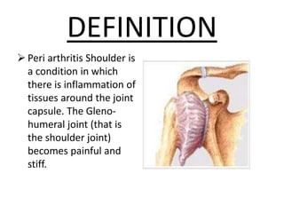Peri arthritis shoulder/ frozen shoulder | PPTX