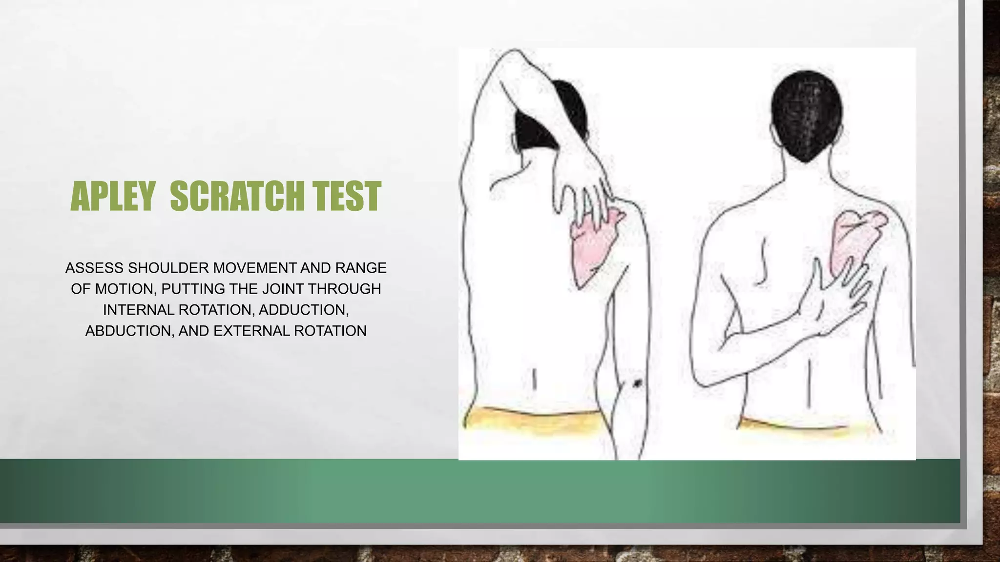 Periarthritis Shoulder.pptx