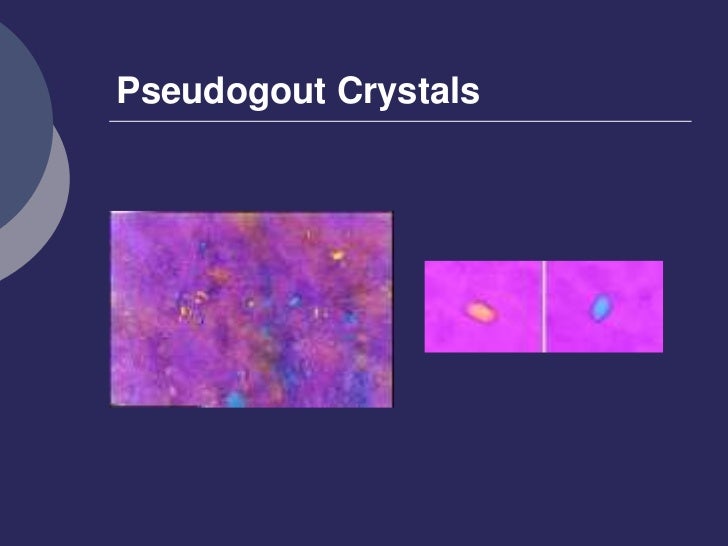 Periarticular Disorders