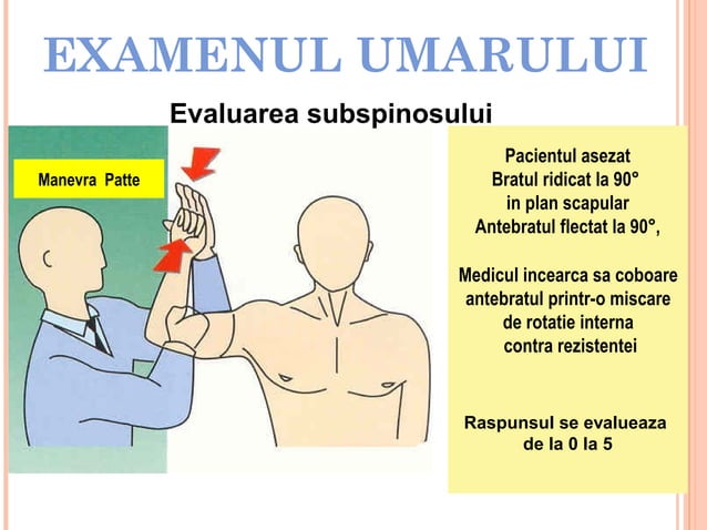 Periartrita scapulo humerala | PPT