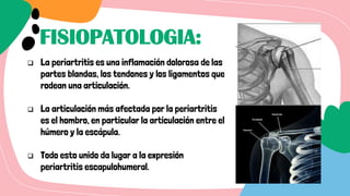 PERIARTRITIS.pptx