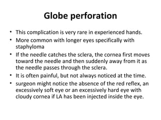 Peribulbar anaesthesia in eye surgery (4) | PPT