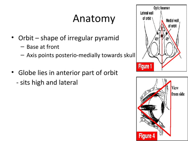 Peribulbar anaesthesia in eye surgery (4) | PPT | Eye and Vision ...