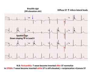 pericardial ESC guidelines | PPT