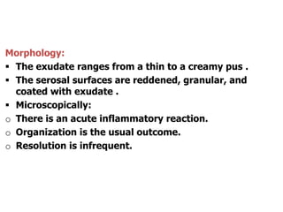 Pericardial dis.&cardiactumors 5 | PPTX