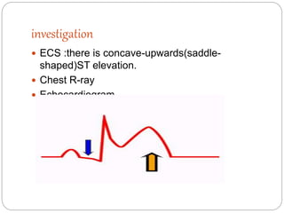Pericardial disease | PPTX