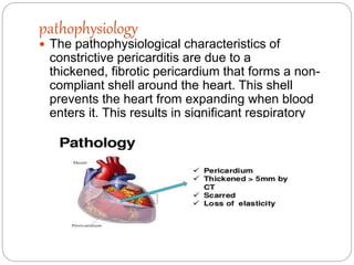 Pericardial disease | PPTX