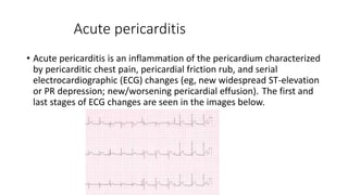 Pericardial Disease Pericardial Disease.pptx | Heart and Cardiovascular Diseases | Diseases and ...