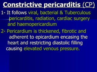 Pericardial Diseases | PPT