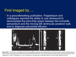 Pericardial diseases | PPTX