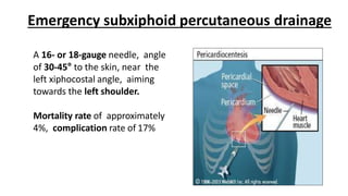 Pericardial diseases | PPTX
