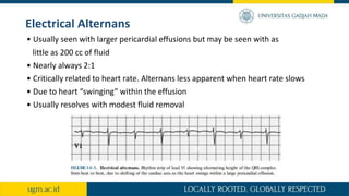 Pericardial Diseases.pptx