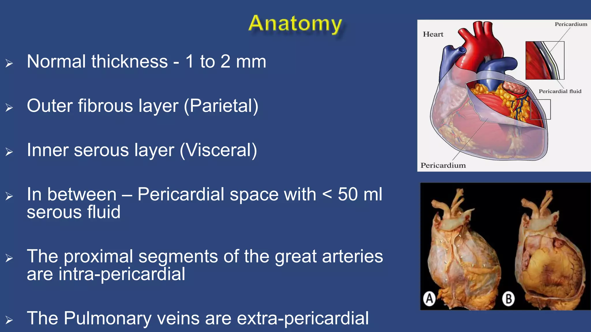 Pericardial diseases 2020 final | PPTX
