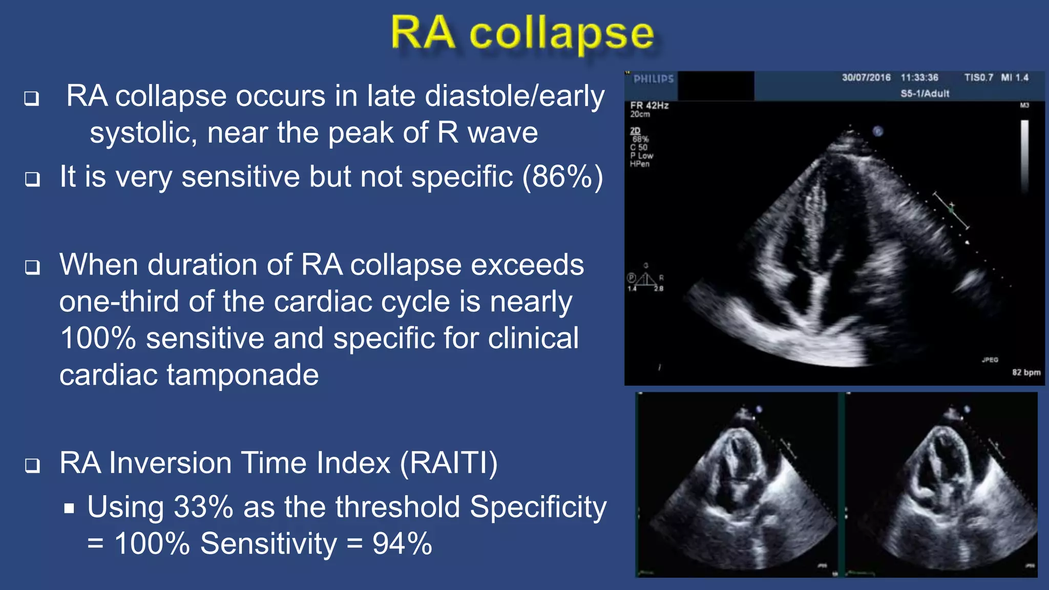 Pericardial diseases 2020 final | PPTX