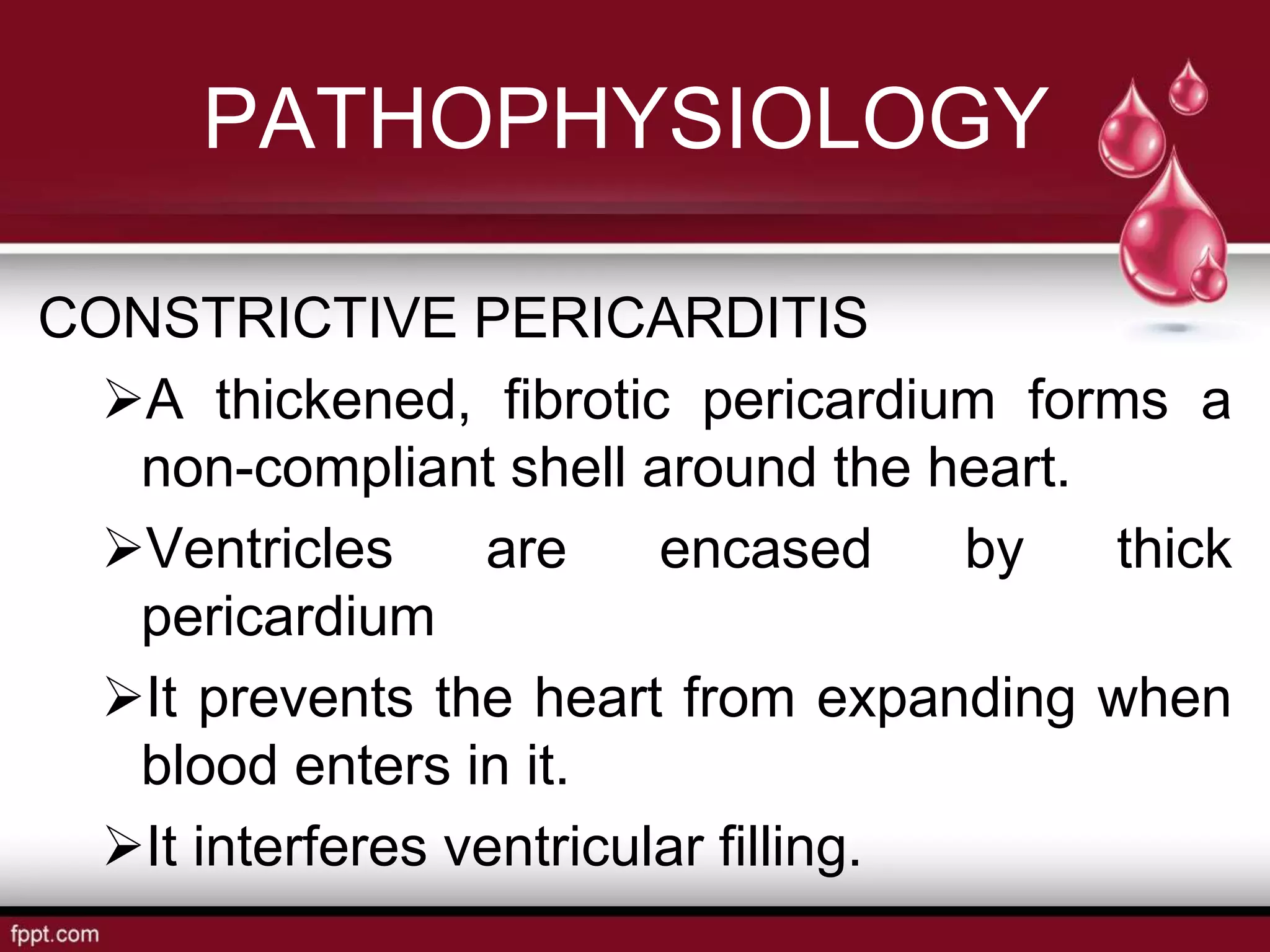 Pericardial diseases part i | PPT | Heart and Cardiovascular Diseases ...