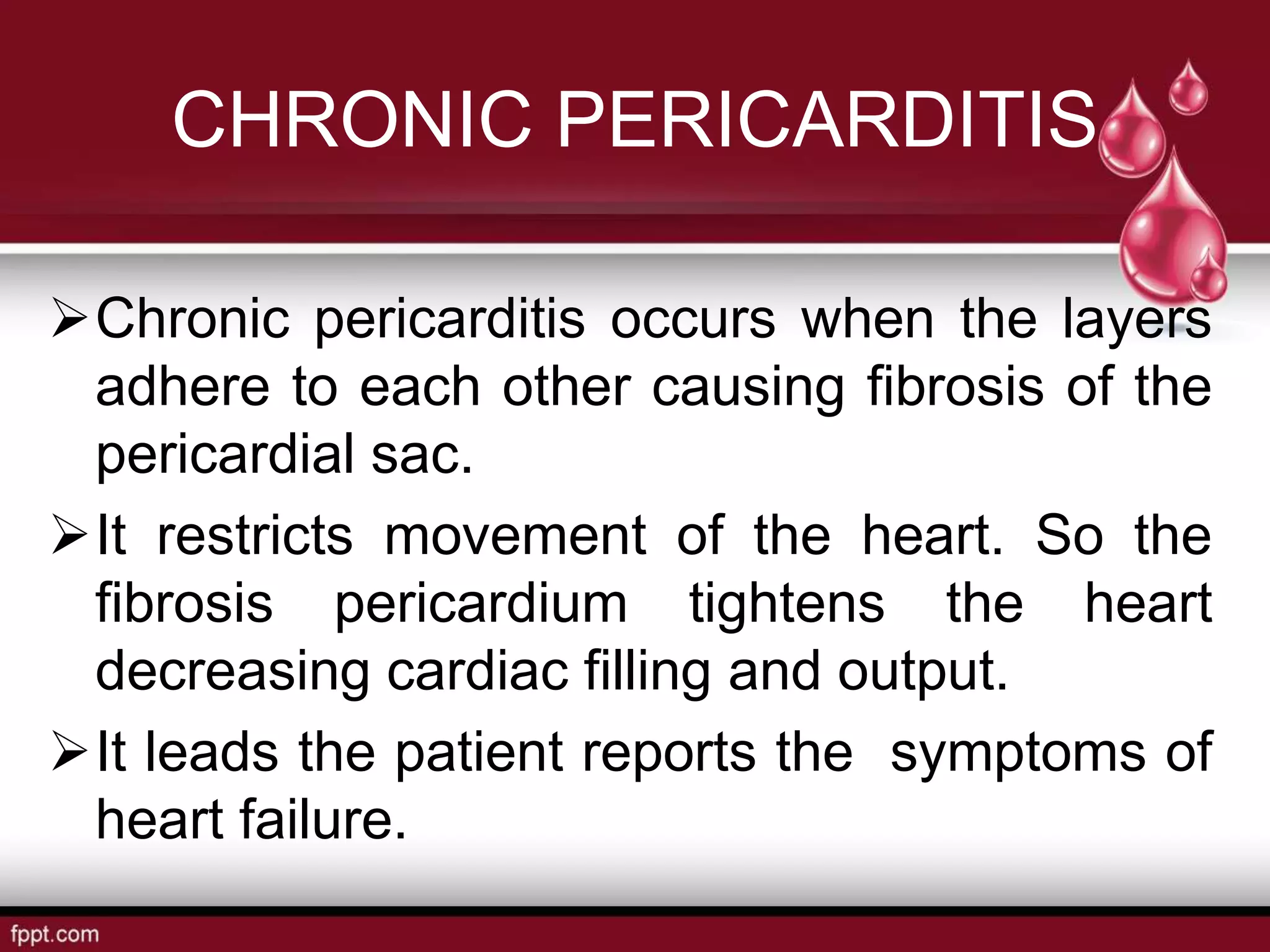 Pericardial diseases part i | PPT
