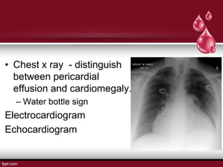 Pericardial diseases part i | PPT
