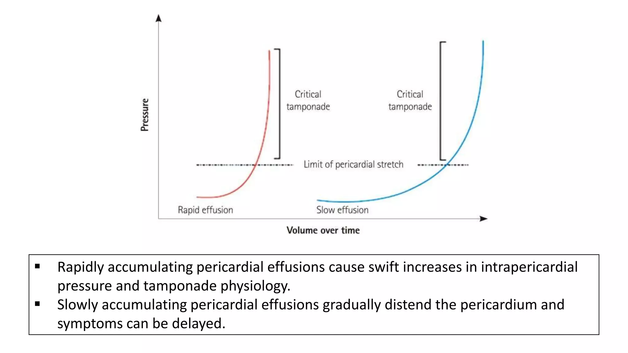EMGuideWire's Radiology Reading Room: Pericardial Effusion | PPTX