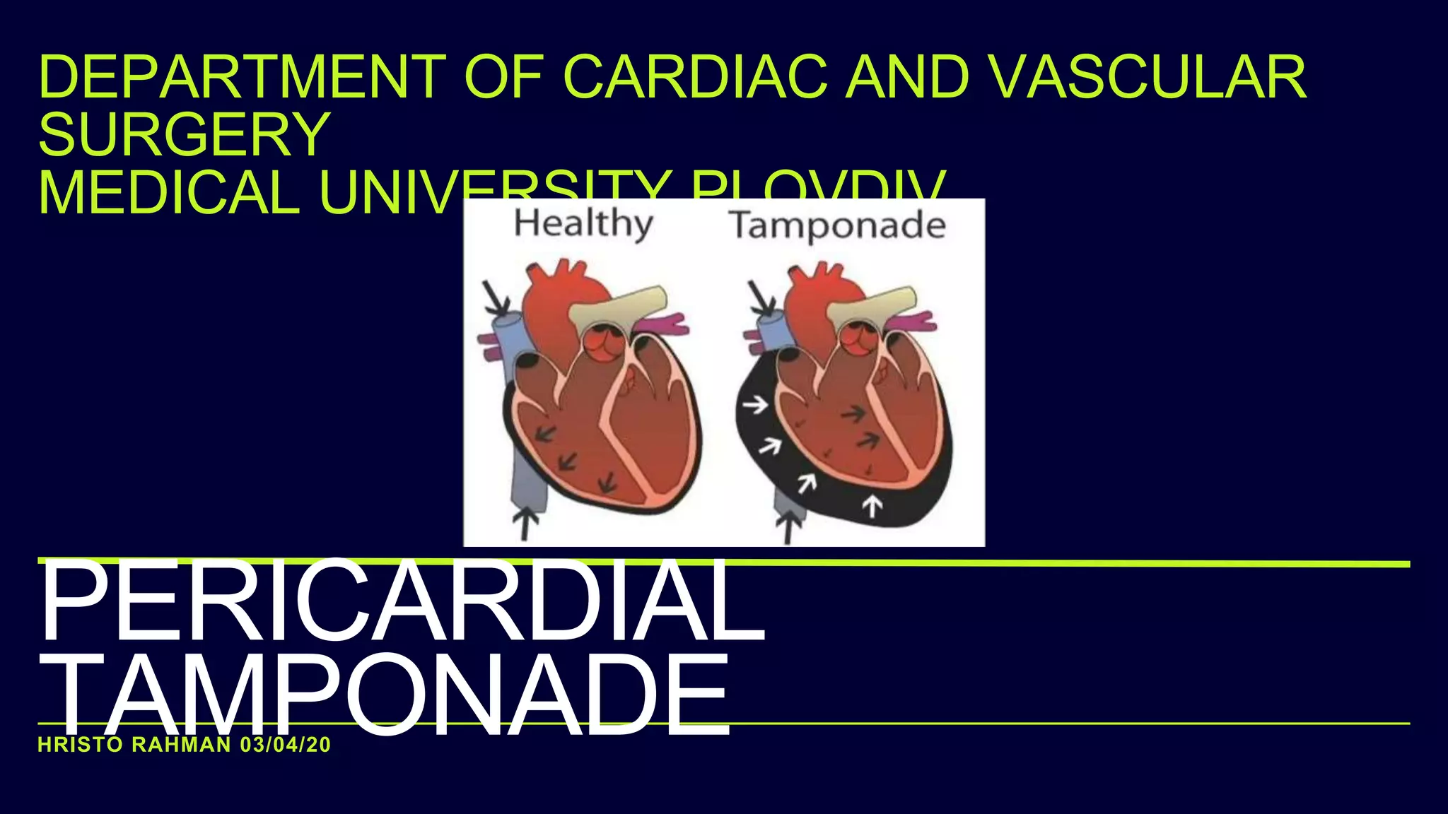 Pericardial tamponade | PPTX