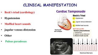 PERICARDIAL TEMPONADE drmousa.pptx