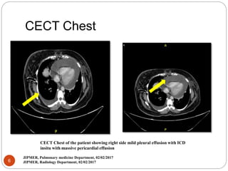 Pericardiocentesis Dog