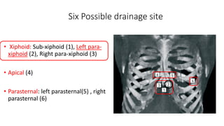 Pericardiocentesis | PDF