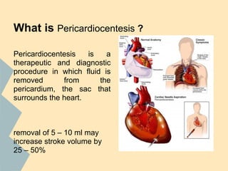 Pericardiocentesis | PDF