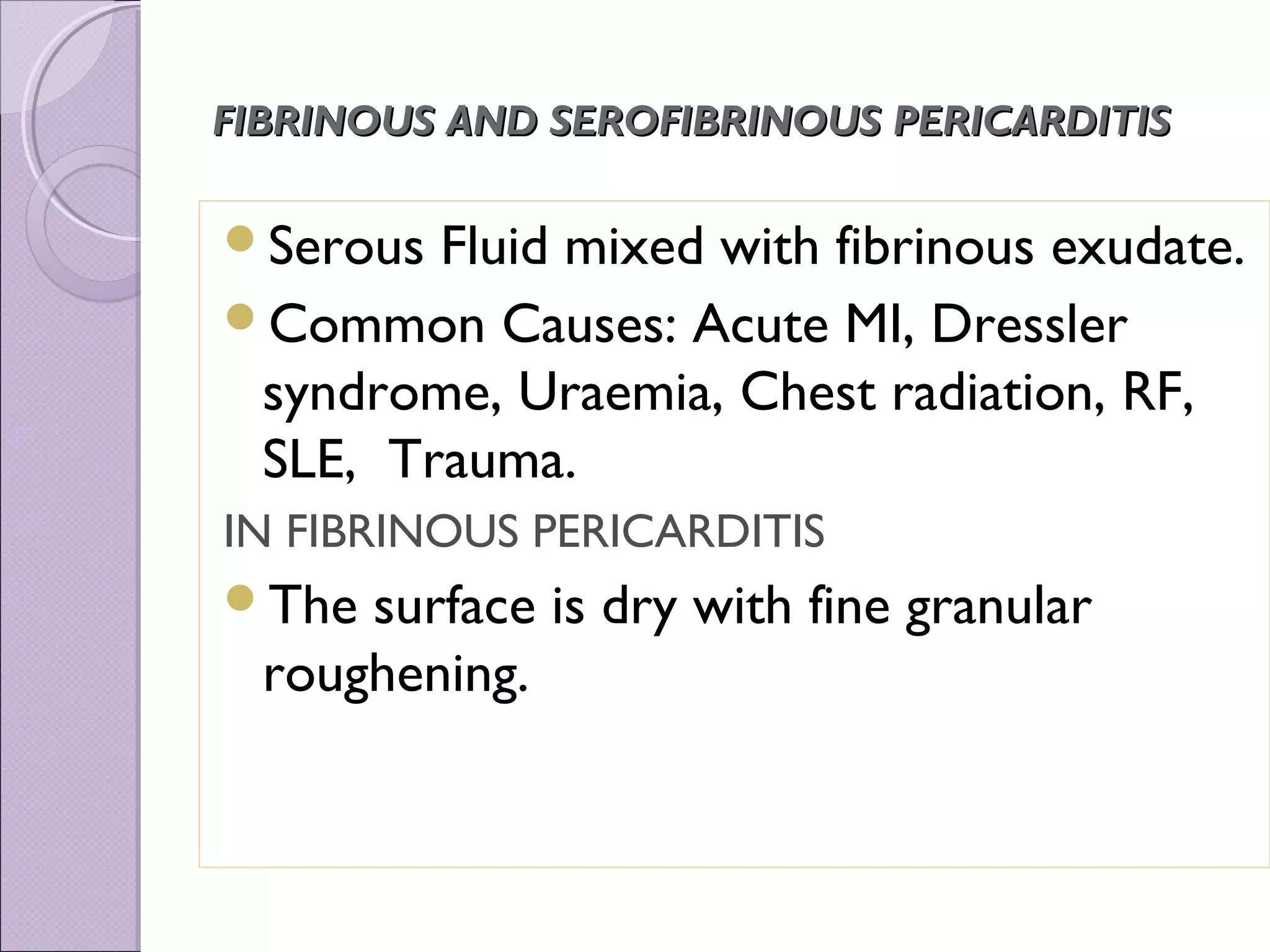 Pericarditis | PPT