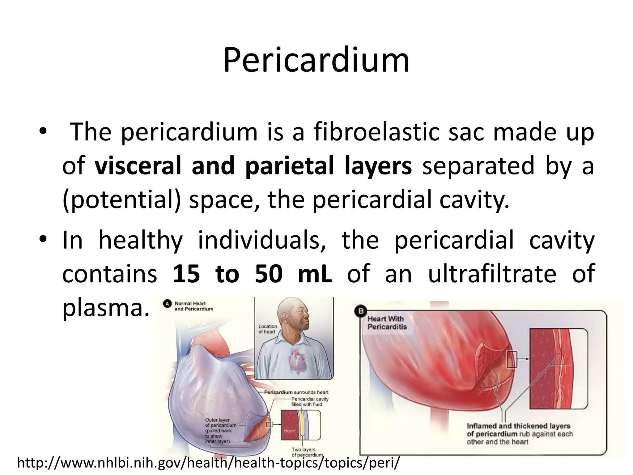 Pericarditis | PPTX