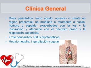 Pericarditis | PPTX