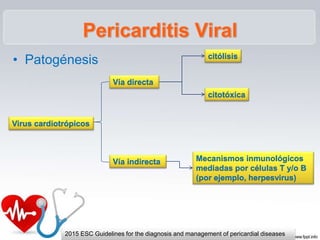 Pericarditis | PPTX