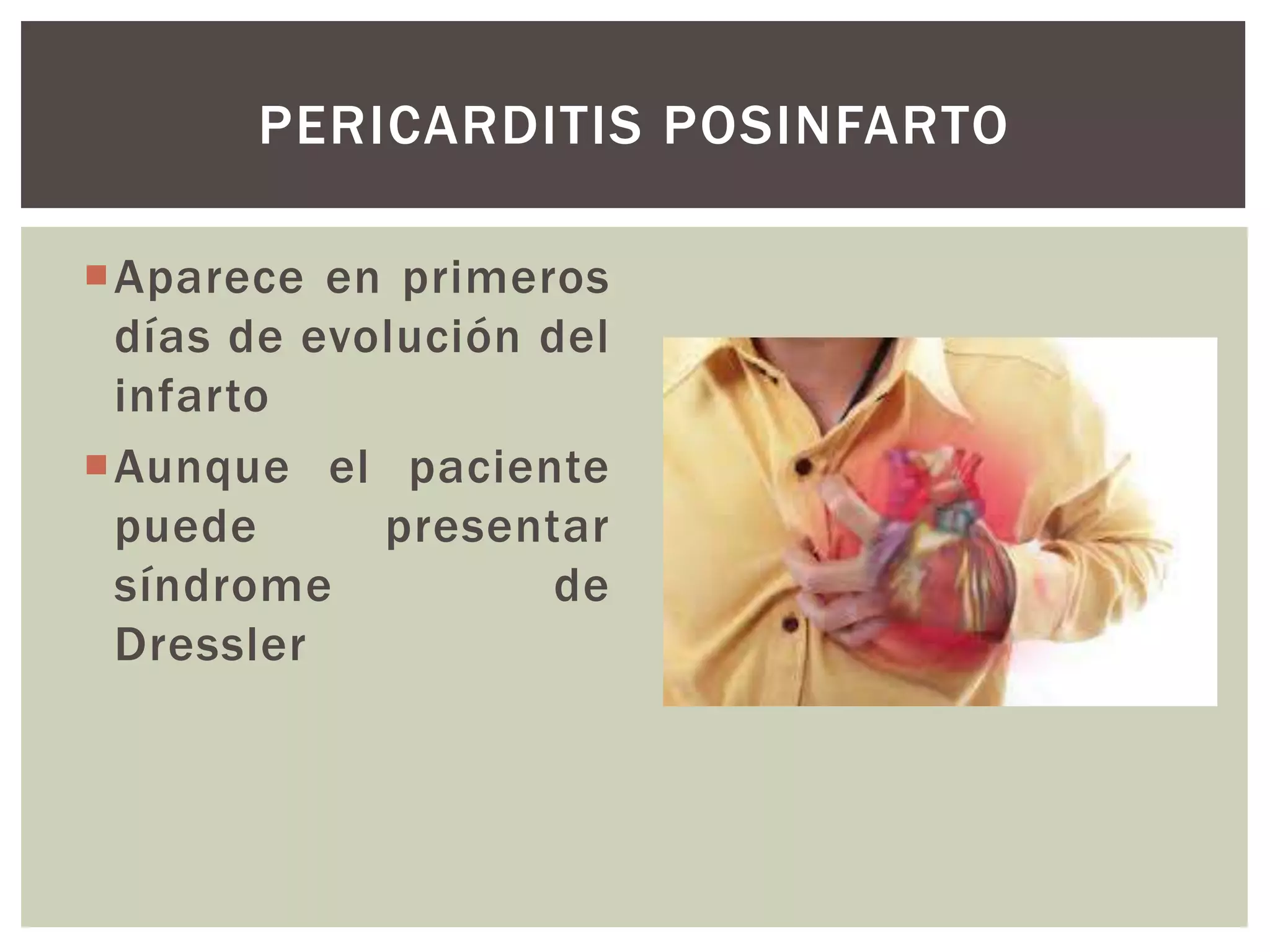 Pericarditis | PPT | Descarga Gratuita