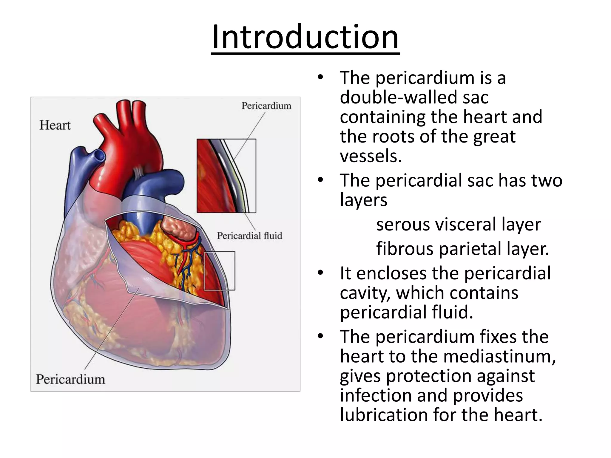 Pericarditis | PPTX