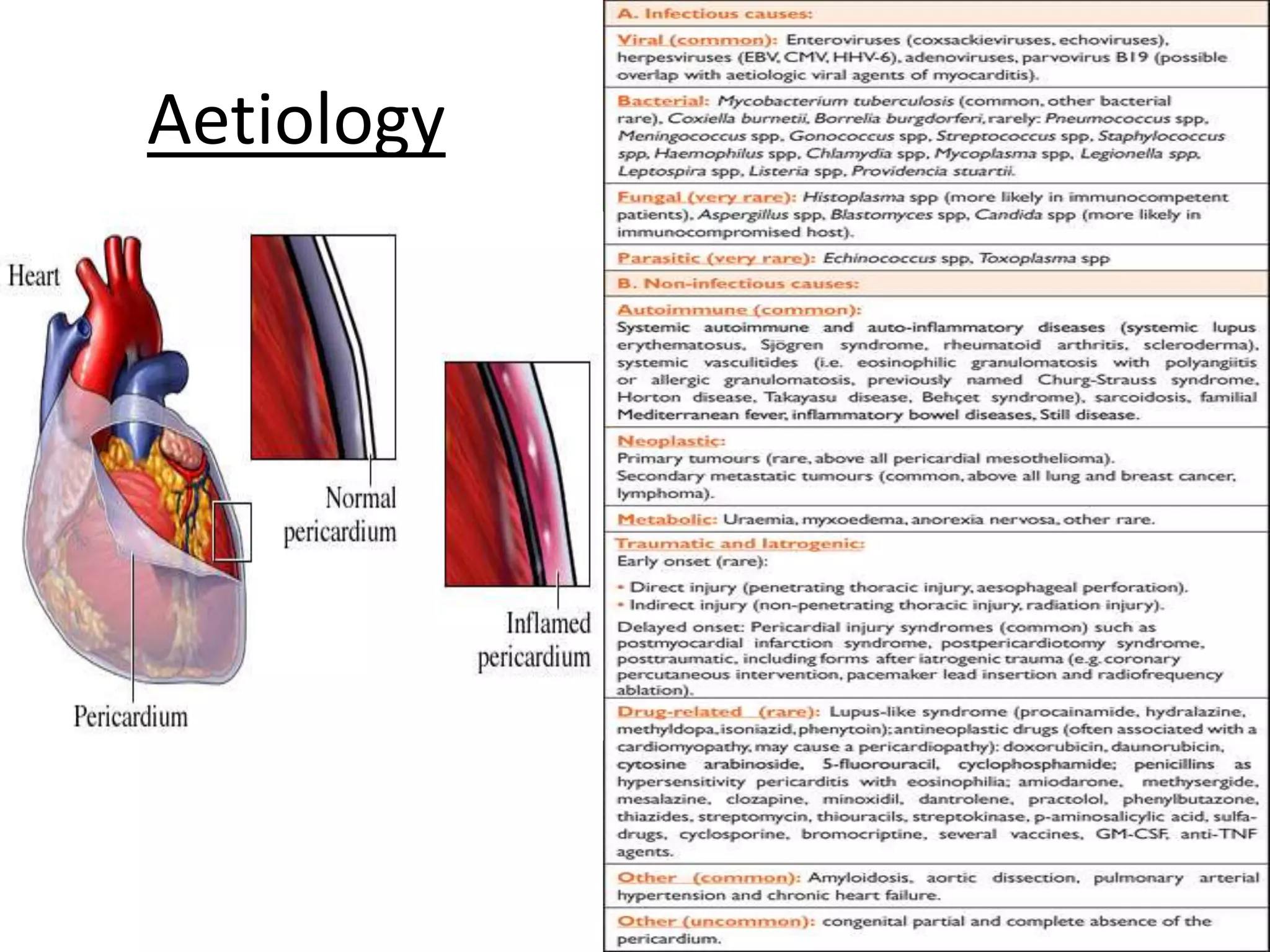 Pericarditis | PPTX