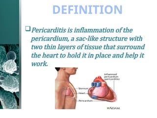 pericarditis-21ydudbbbjgijj0515080610.pptx
