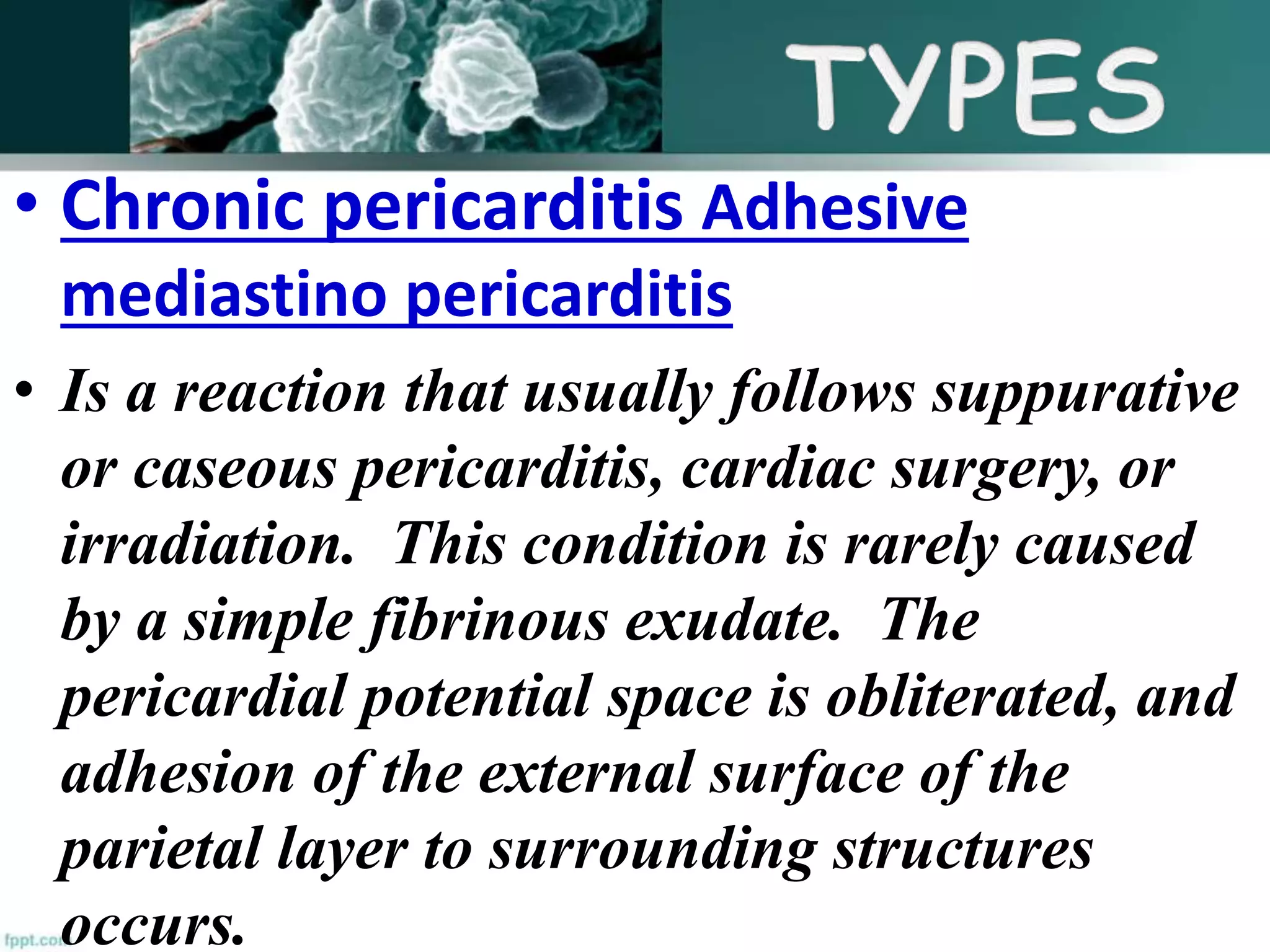 Pericarditis | PPTX