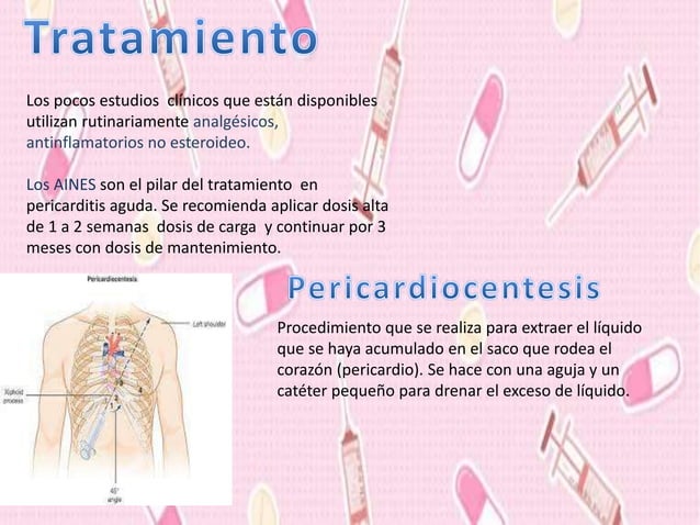 Pericarditis anatomía, fisiopatología, síntomas, tratamiento ...