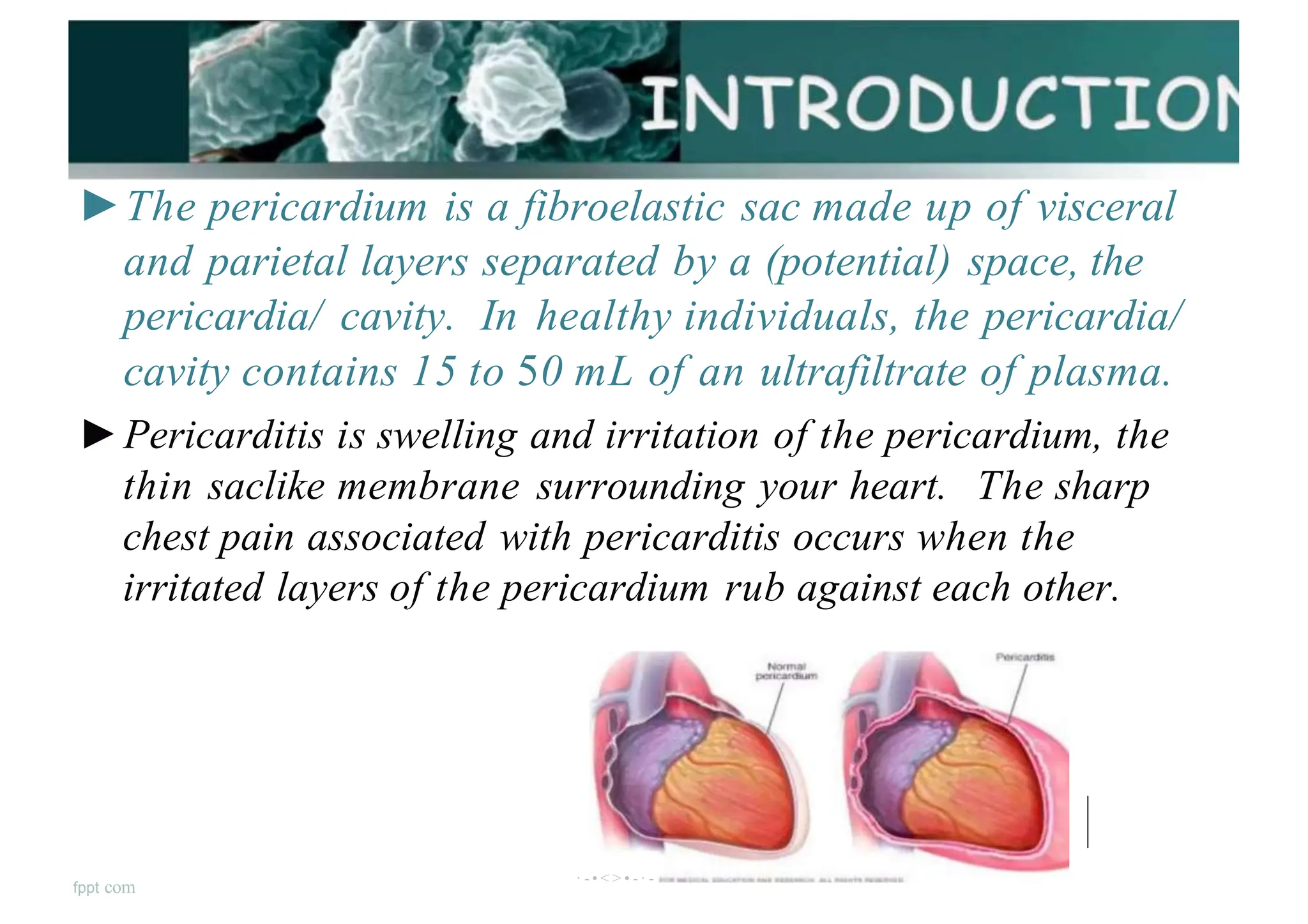 Pericarditis is inflammation of the pericardium (the fibrous sac ...