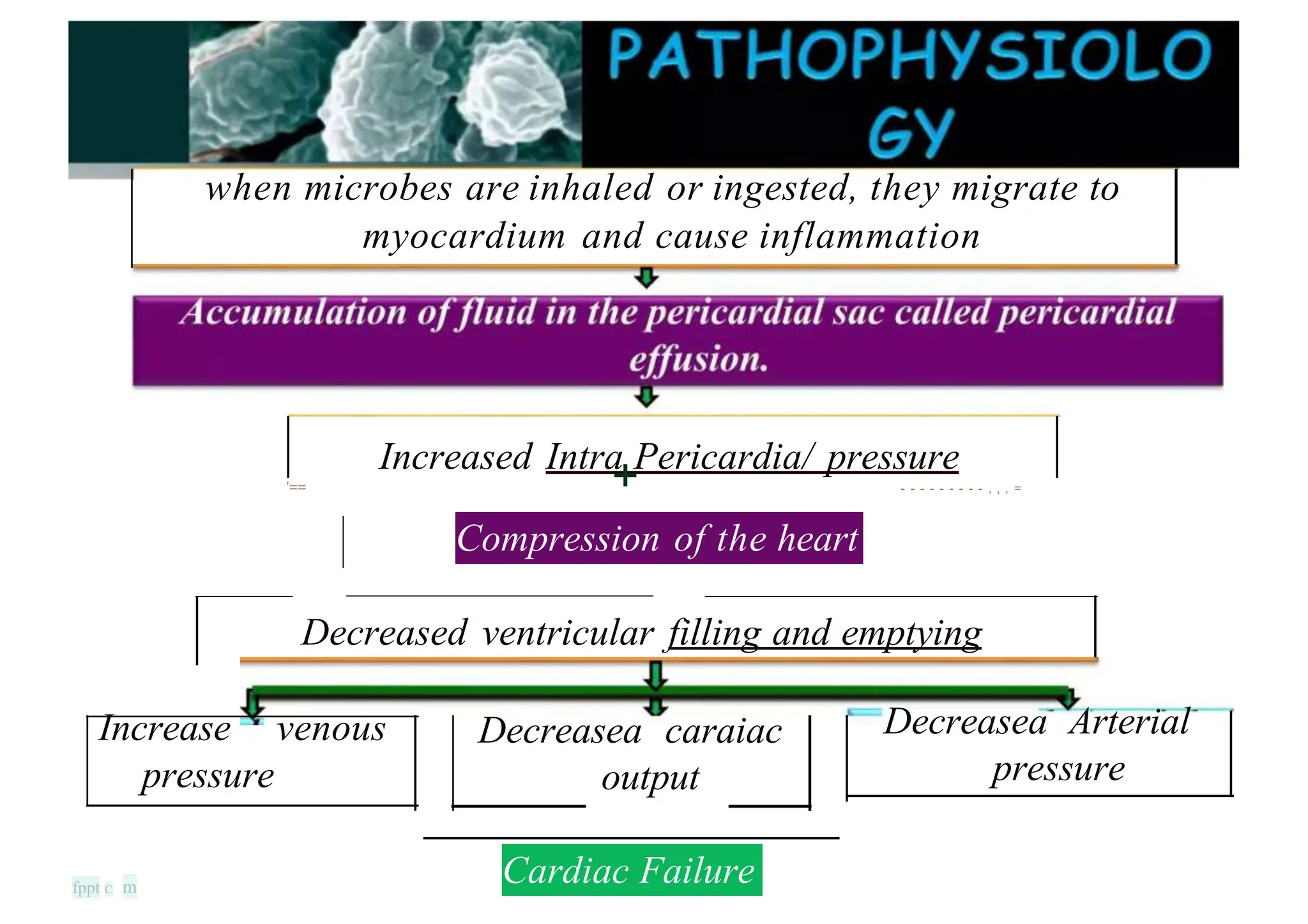 Pericarditis is inflammation of the pericardium (the fibrous sac ...