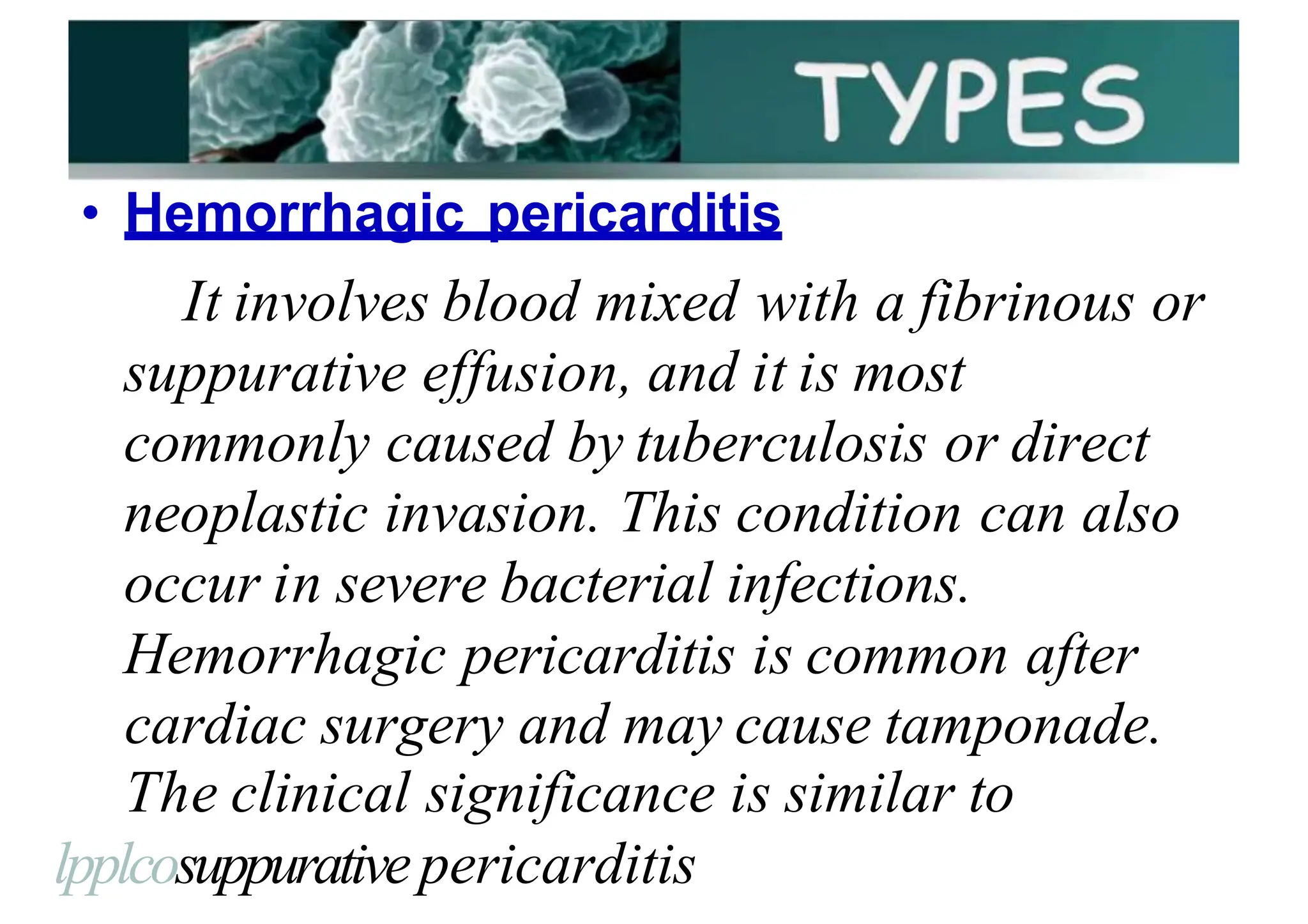 Pericarditis is inflammation of the pericardium (the fibrous sac ...